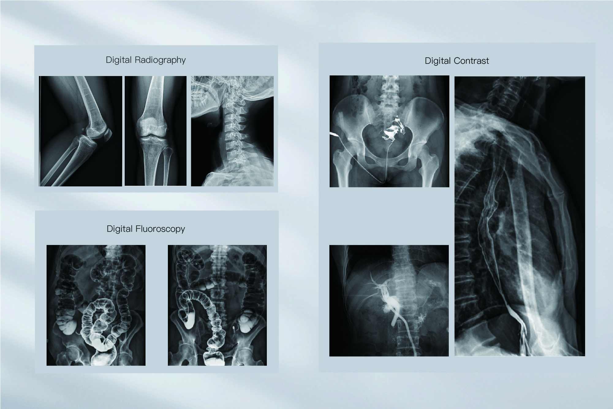 Dynamic Digital Radiography System&Fluoroscope DR-SONTU China